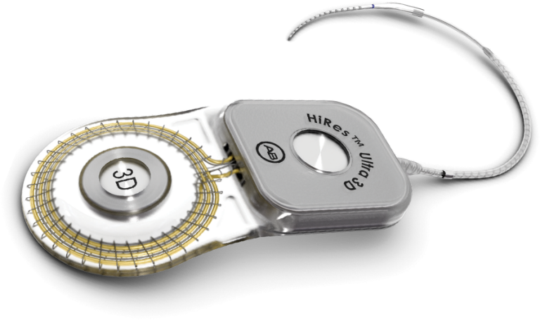 Cochlear Implants For Adults | Advanced Bionics