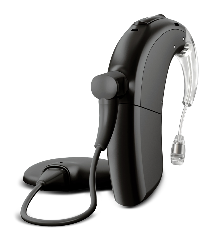 How Cochlear Implants Work | Advanced Bionics