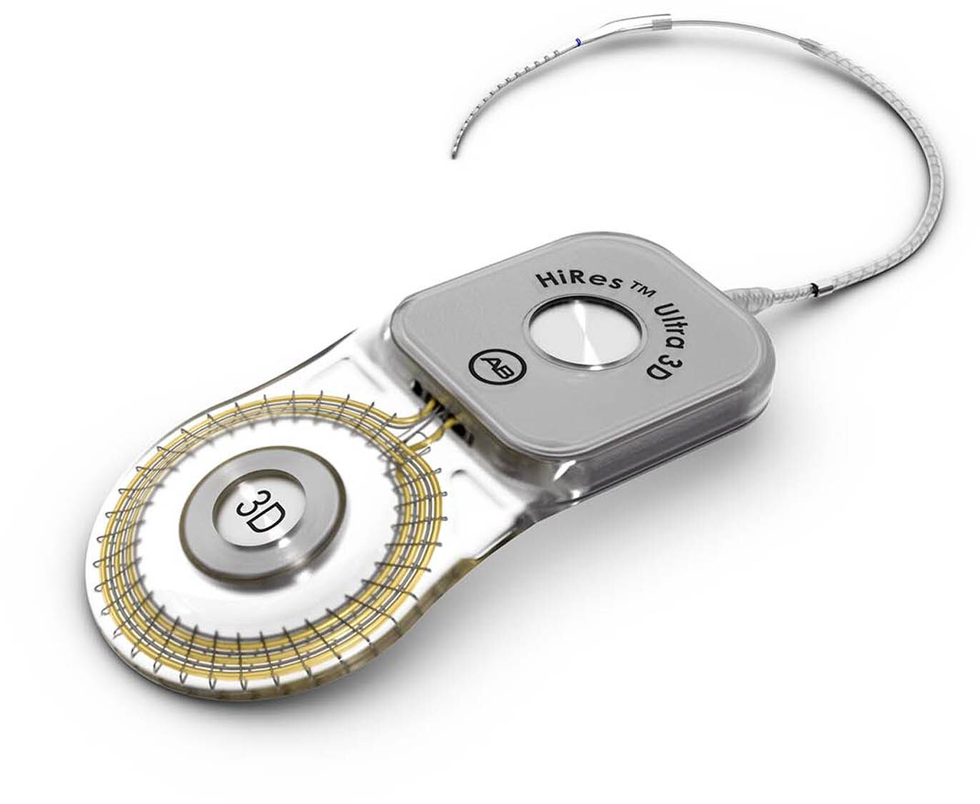 Cochlear Implant Surgery: Frequently Asked Questions | Advanced Bionics