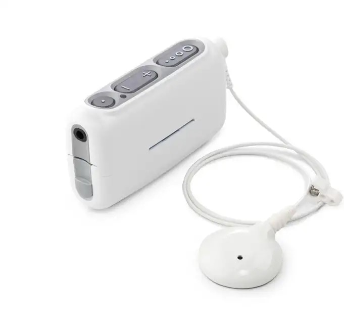 Chorus Sound Processor | Advanced Bionics